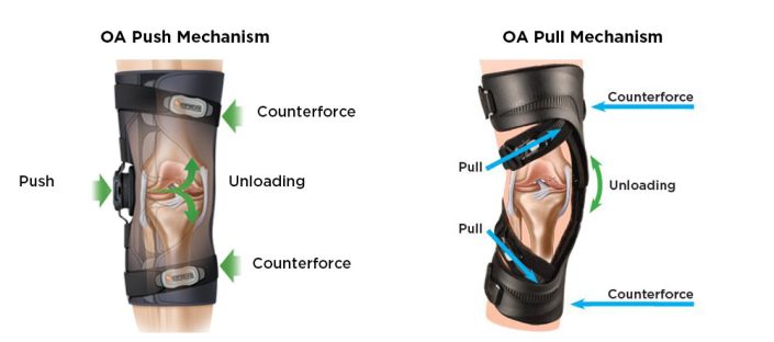 Knee Bracing – Breg, Inc.